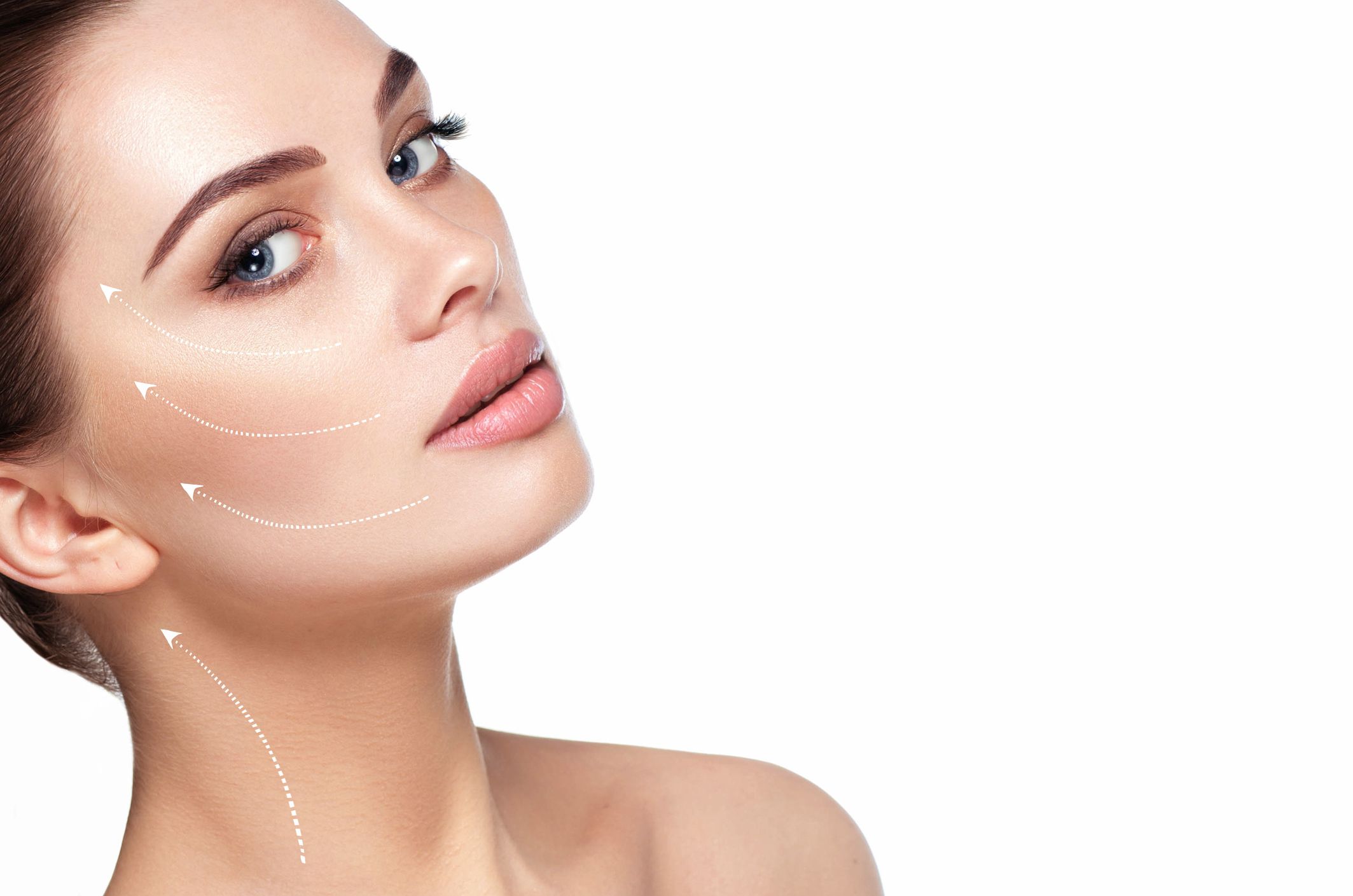 Microneedling - Vampire Facelift - The Essential Clinic